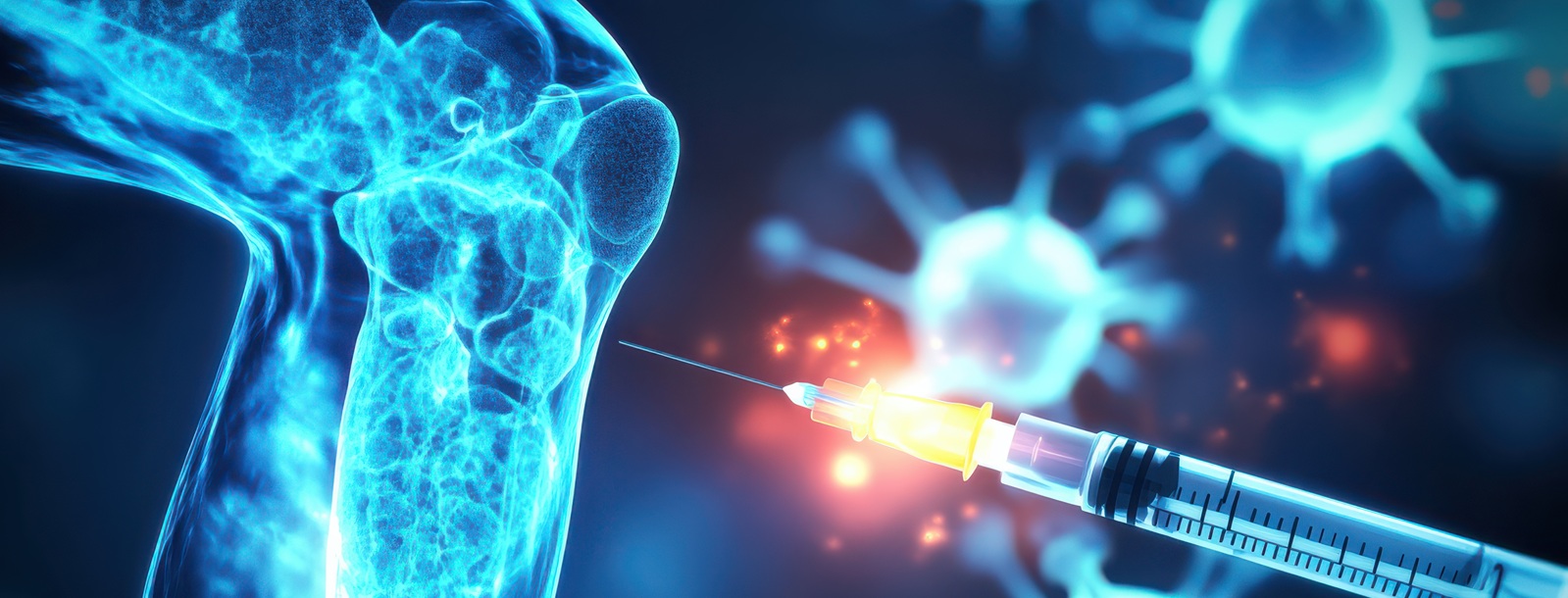 Gel Knee Injections | Viscosupplementation & Hyaluronic Acid Injections